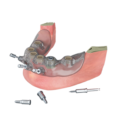 B&B DIGITAL SURGICAL GUIDE