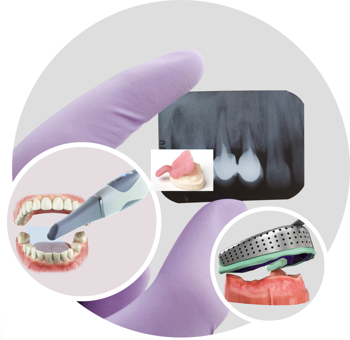 B&B DIGITAL SURGICAL GUIDE