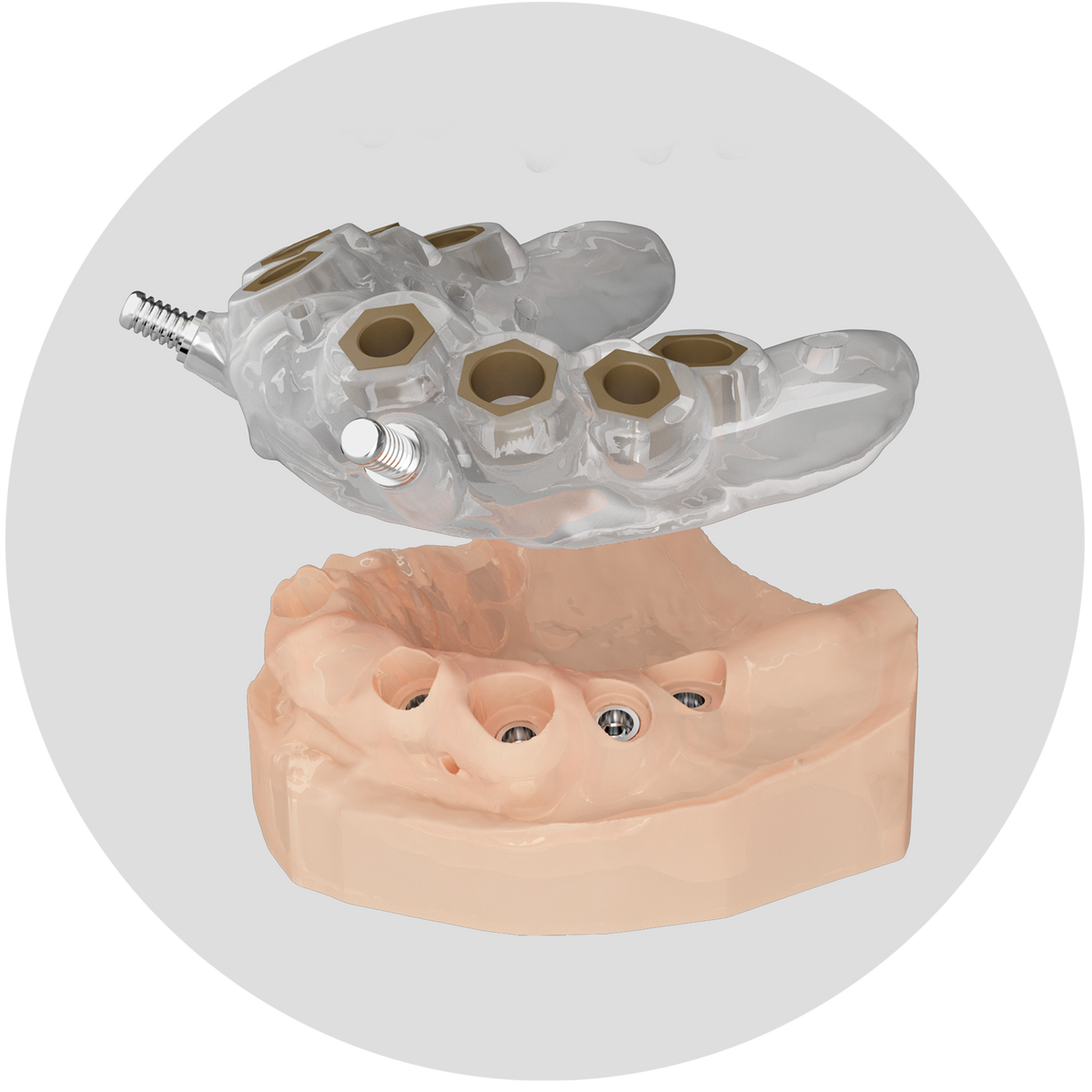 B&B DIGITAL SURGICAL GUIDE