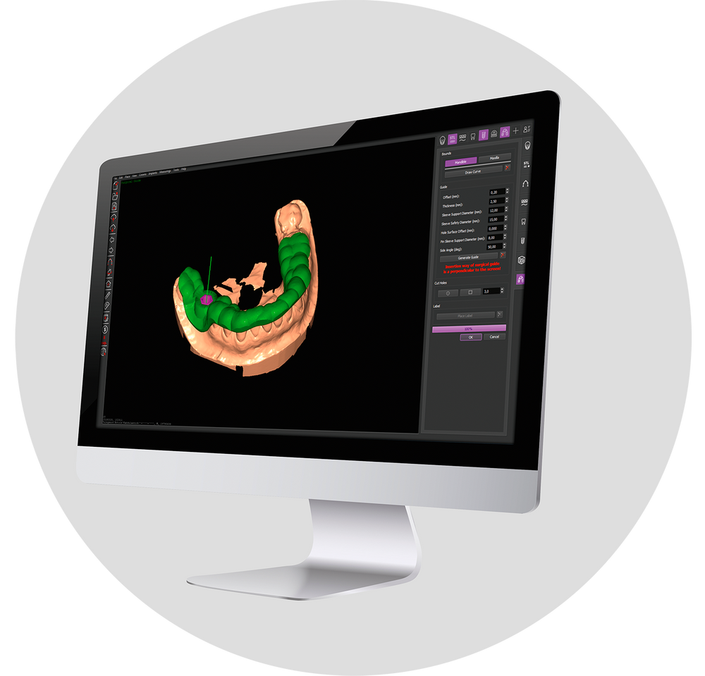 B&B DIGITAL SURGICAL GUIDE